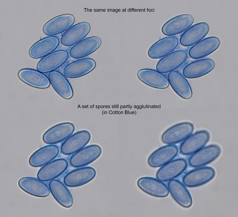 Cheilymenia fimicola Fungus Species