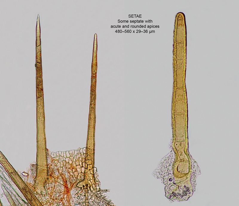 Cheilymenia fimicola Fungus Species